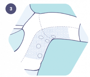 HidraWear - Wound care solution, adhesive free for hidradenitis suppurativa